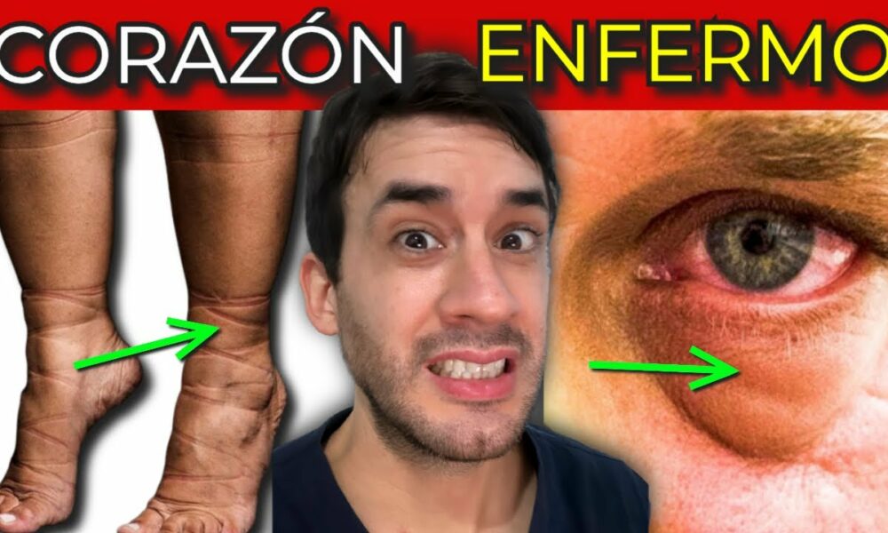 ¡Cuidado! Tu corazón está en riesgo: Descubre cómo protegerlo – Noticito